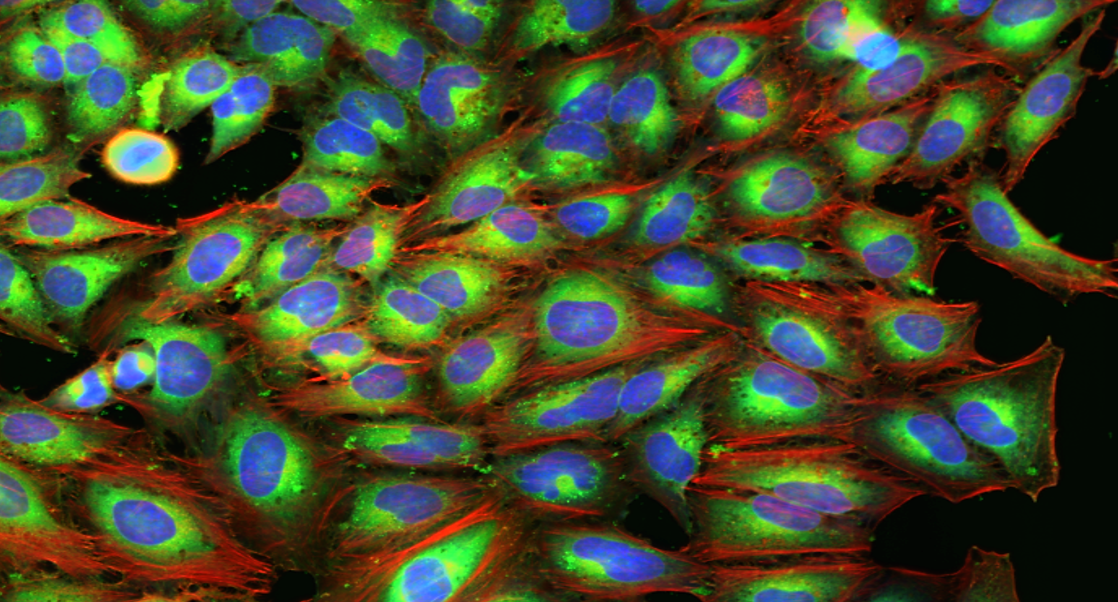 Art of the Science: Cell Painting | Charles River