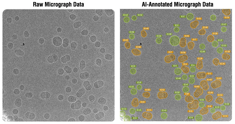 Revolutionizing Lipid Nanoparticle Analysis with Machine Learning ...