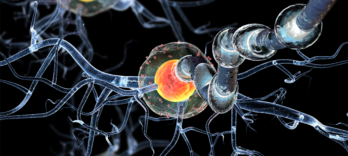 Spotlight on MS Research (Video) | Charles River