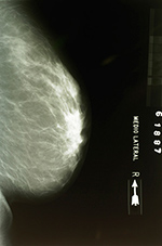 Making Sense of Mammography | Charles River
