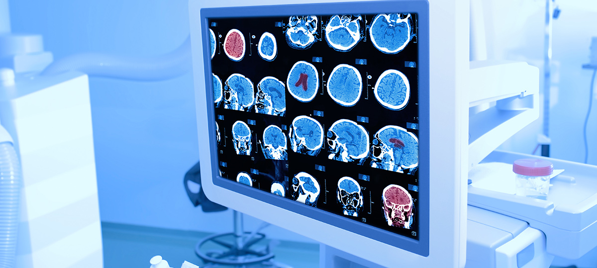 The Invention of Computed Tomography | Charles River