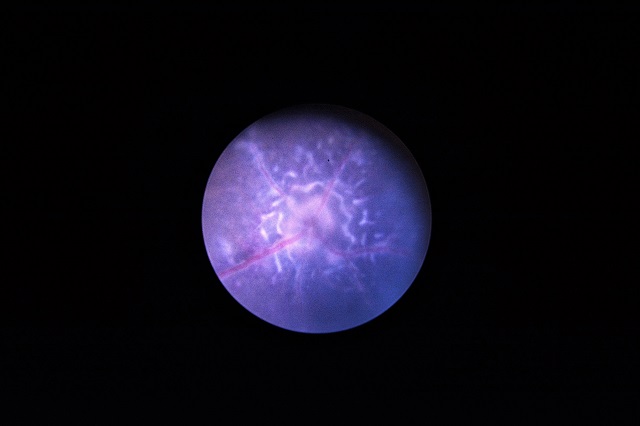 Autoimmune Uveitis Model | Charles River