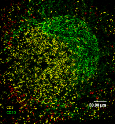 Inflammation and Autoimmune B cell assays | Charles River