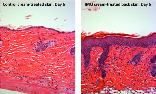 Psoriasis mouse model | Charles River
