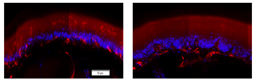 Neuropathic Pain Models | Charles River