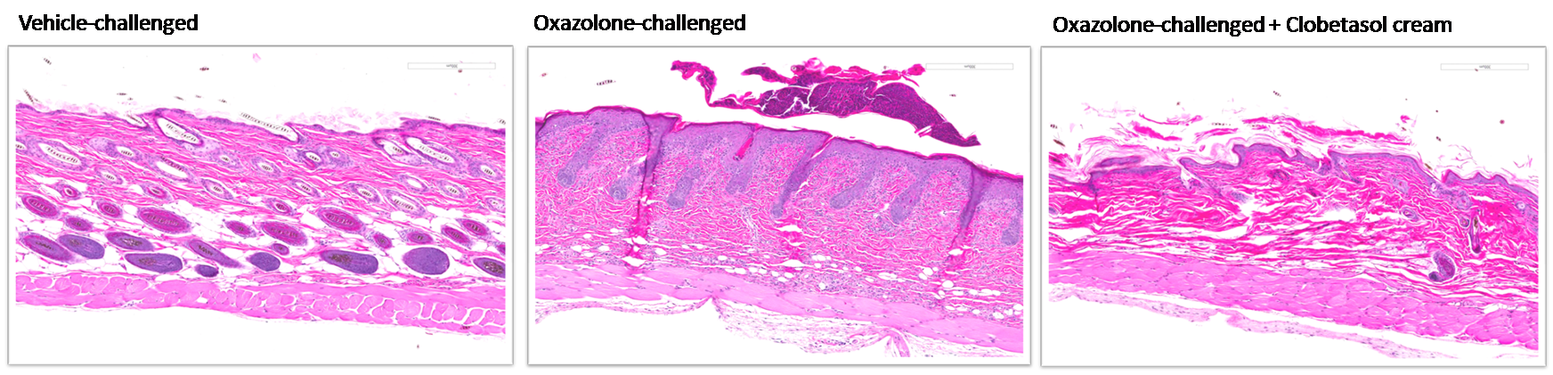 Atopic Dermatitis Models | Charles River