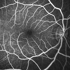 Choroidal Neovascularization Model | Charles River