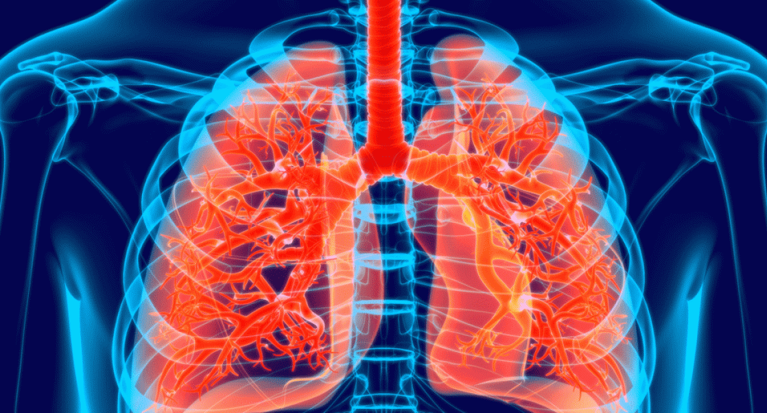 A Fitness Model for Tumors | Charles River