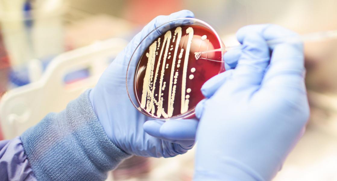 You Say Odoribacter, I Say… Bacillus? | Charles River